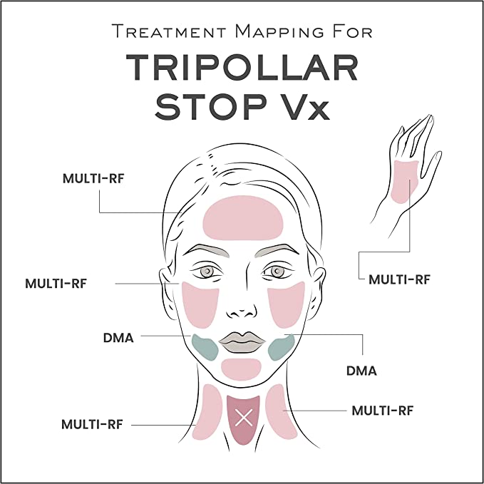 Tripollar Stop Vx - Radio Frequency Skin Tightening and Facial Machine ...